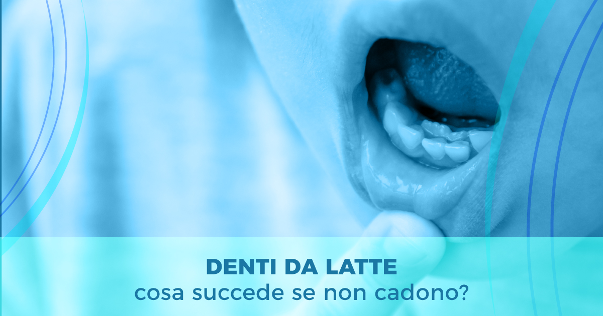 Denti da latte: cosa succede se non cadono - SpazioDental