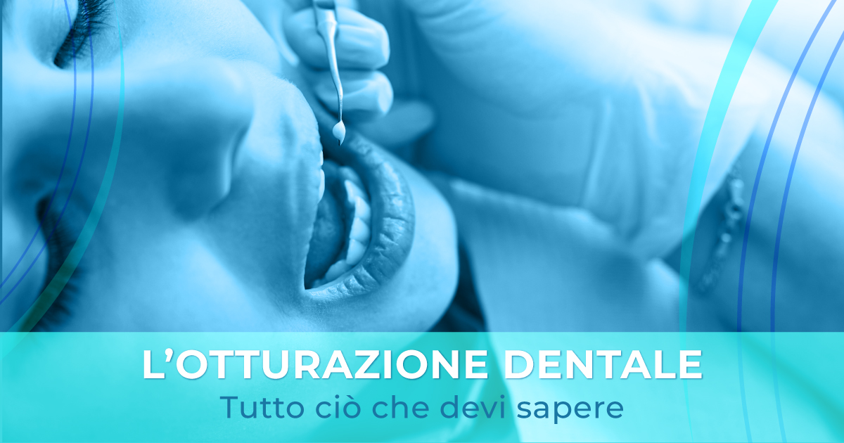 Otturazione dentale: tutto ciò che devi sapere - SpazioDental